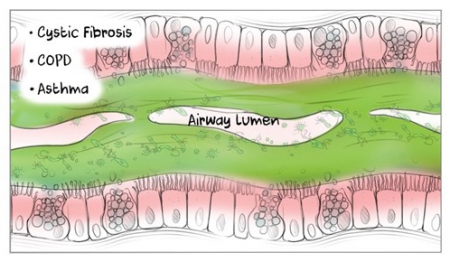Muco-regulatory approach to treat respiratory diseases – Enterprise ...