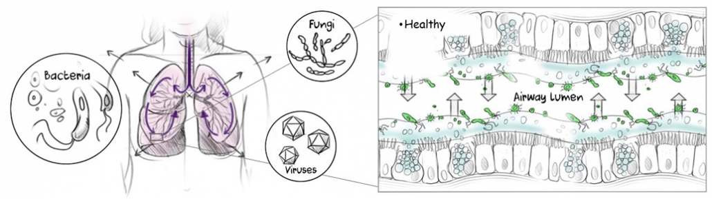 Muco-regulatory approach to treat respiratory diseases – Enterprise ...